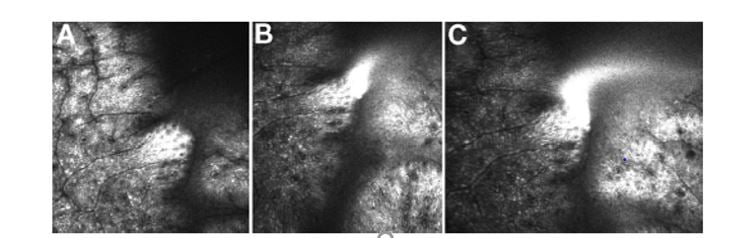 Jelito drażliwe | Dr. Małgorzata Desmond